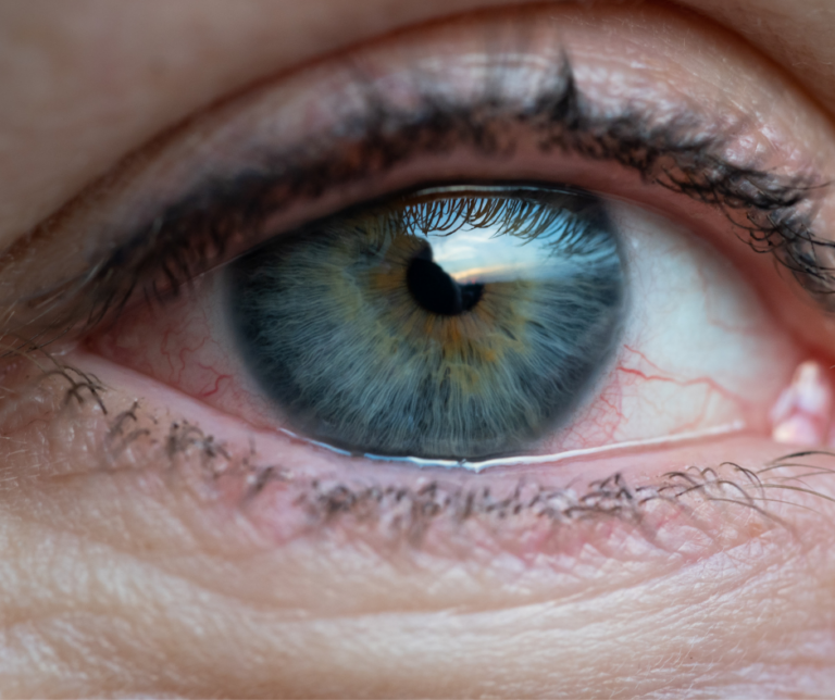 How Sleep Affects Your Vision: The Eye Health Connection